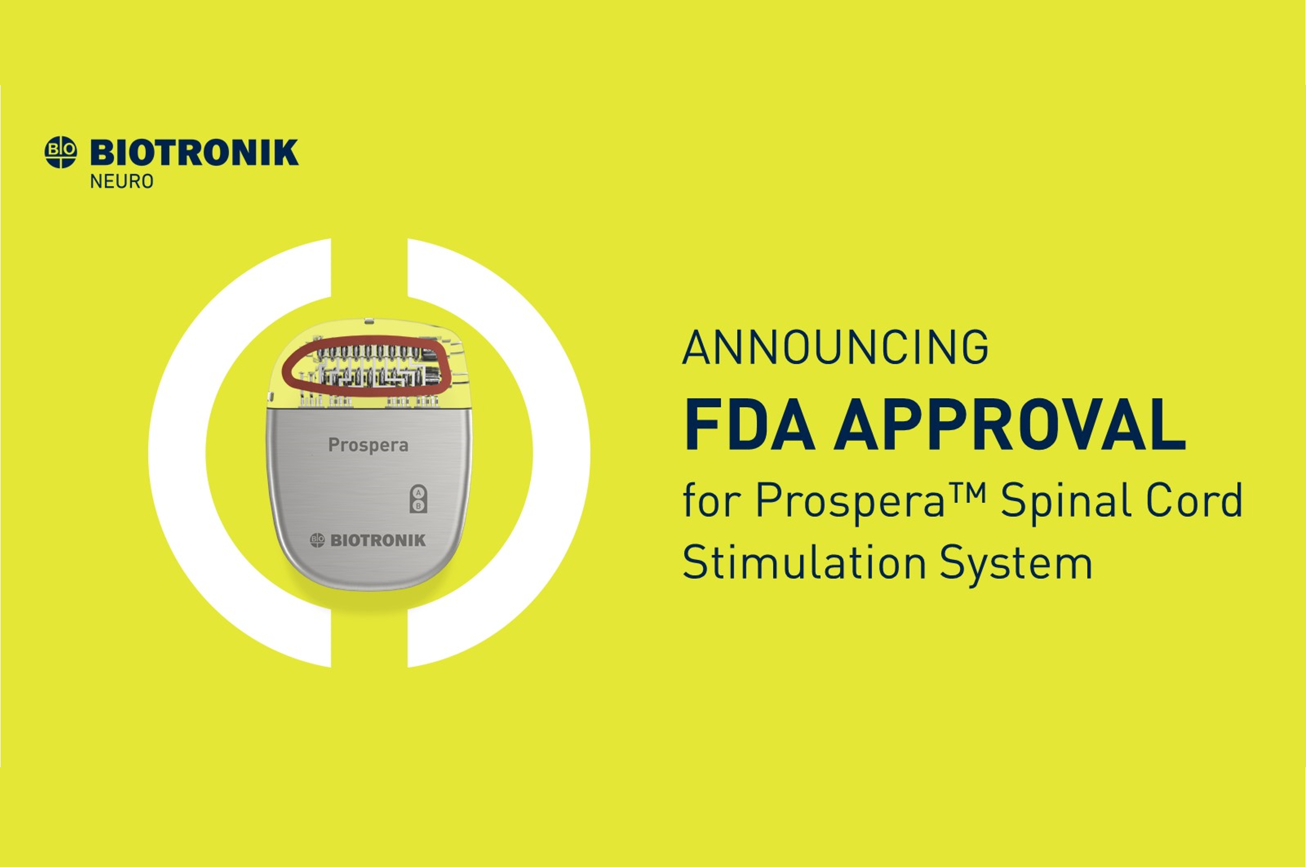 FDA Approval for BIOTRONIK’s Prospera™ Spinal Cord Stimulation System | Biotronik